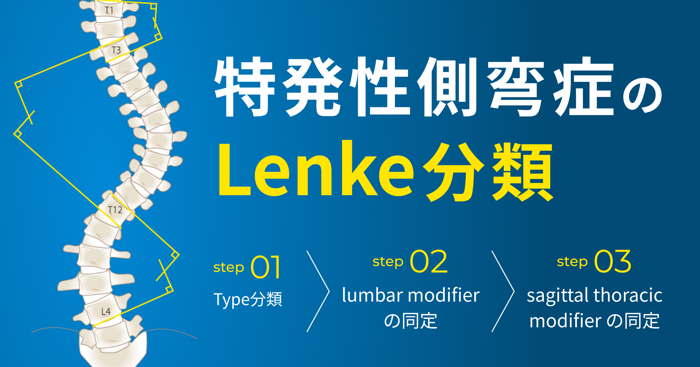 特発性側弯症のLenke分類 | Medeco Pro